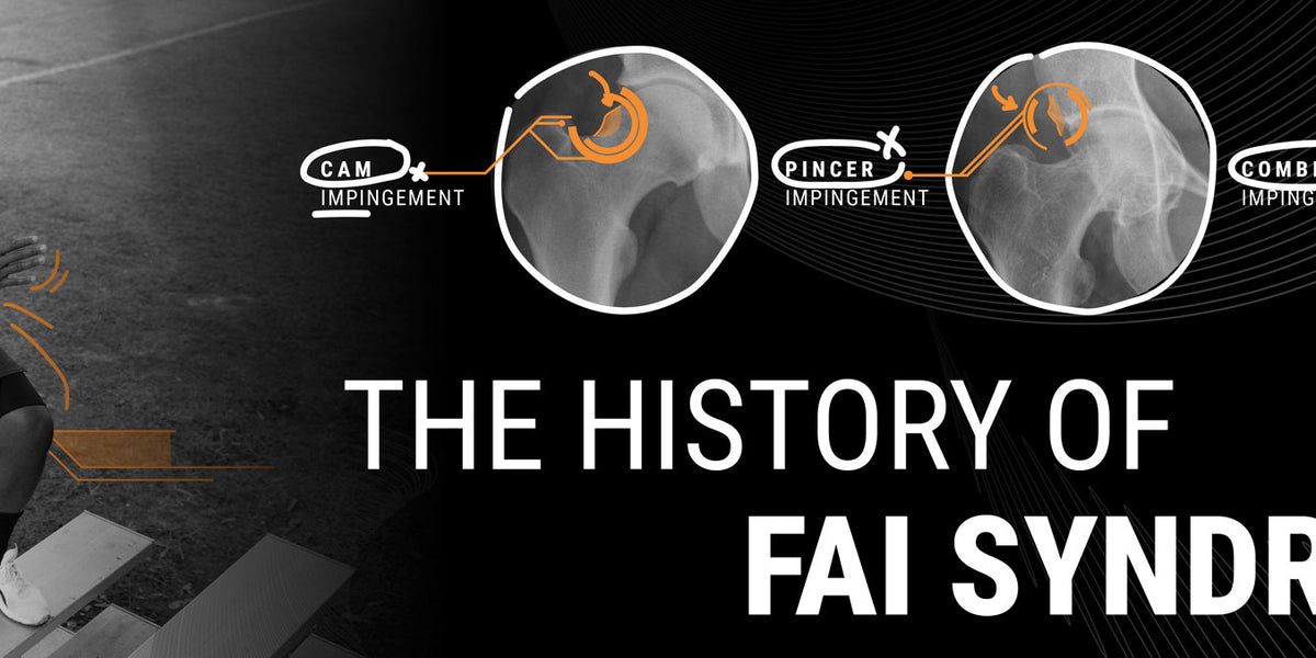 The History of Femoroacetabular Impingement (FAI) Syndrome | SAFS Shorts
